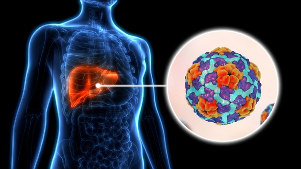Hepatitis A y Seguridad Alimentaria